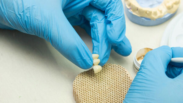 Temporary Crown Resin (#3164) - IFUN3D