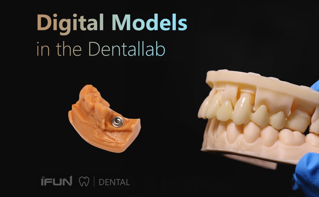 iFUN Dental 3D Printer Resin For Digitization