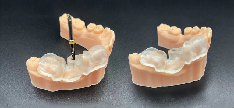 iFUN Dental 3D Printer Resin For Digitization