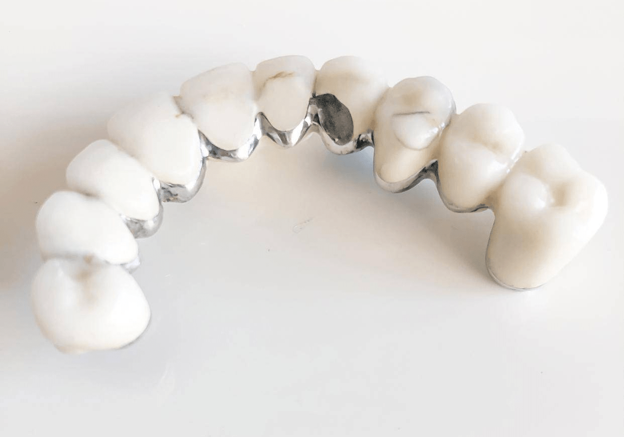 What’s the Best Material for a Dental Crown? | Ifun3d
