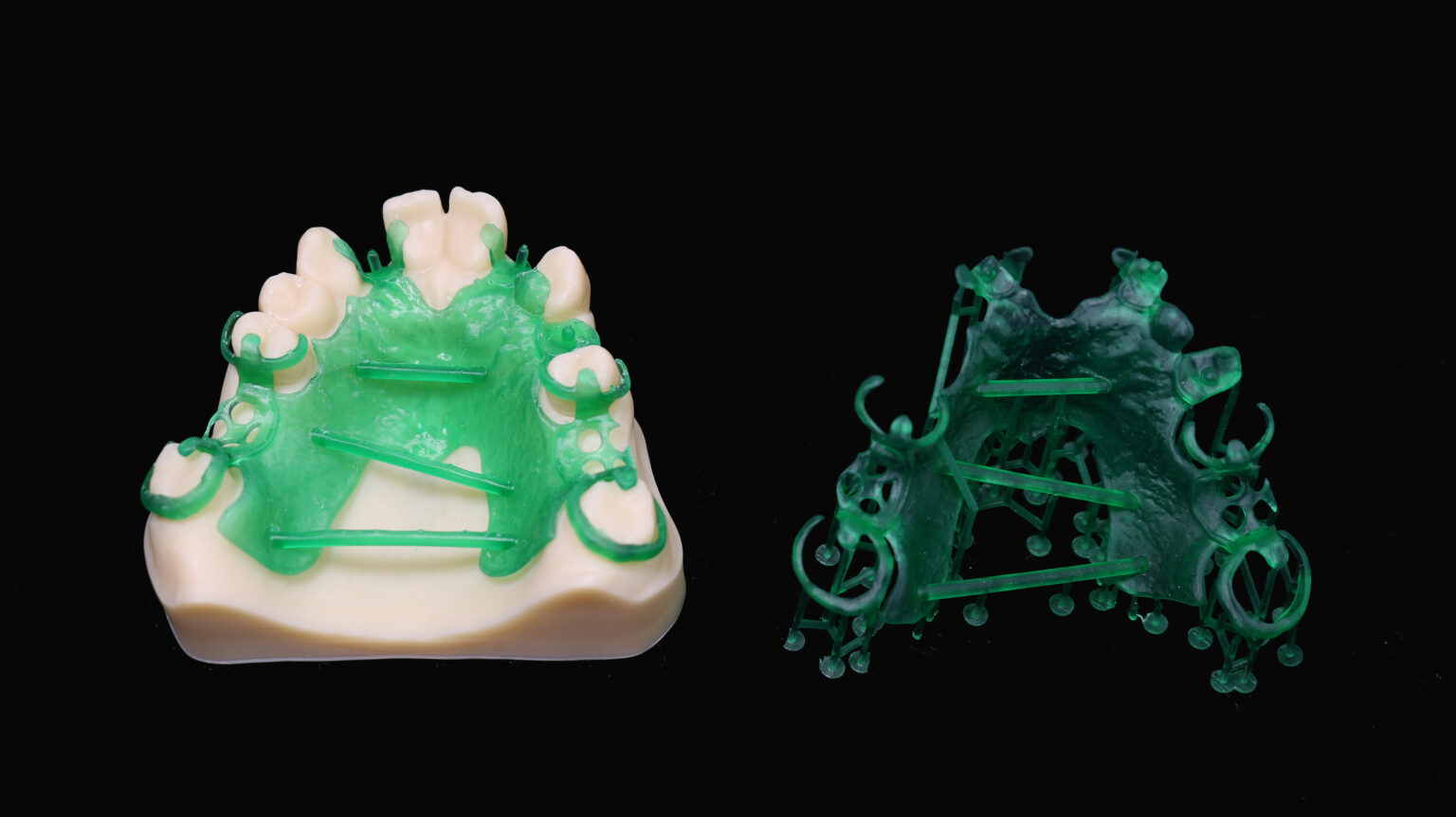 How 3D Printing Enhances Cast Metal Partial Dentures